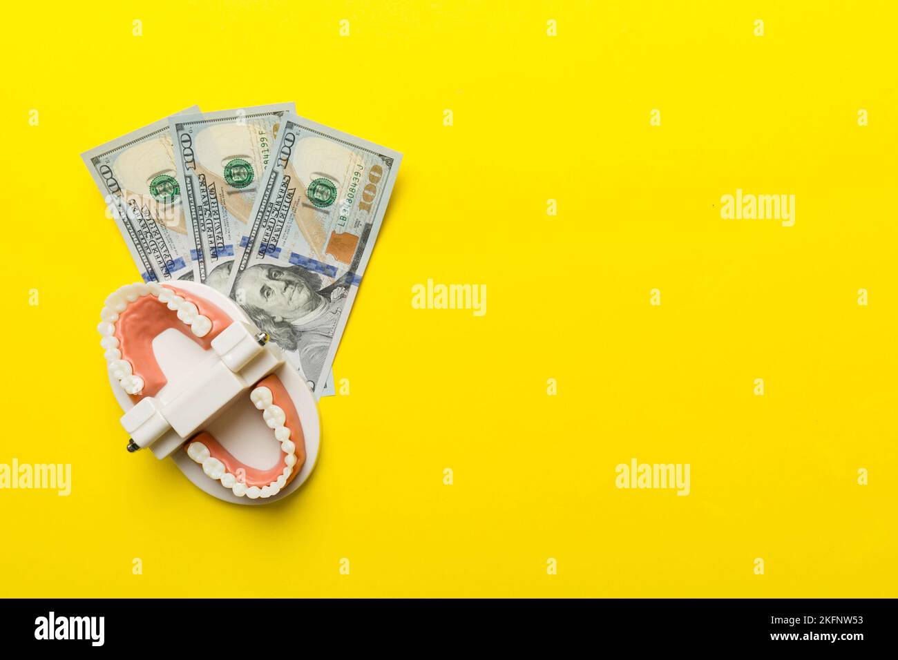 Closeup model of a human jaw with white teeth and dollar bill ...