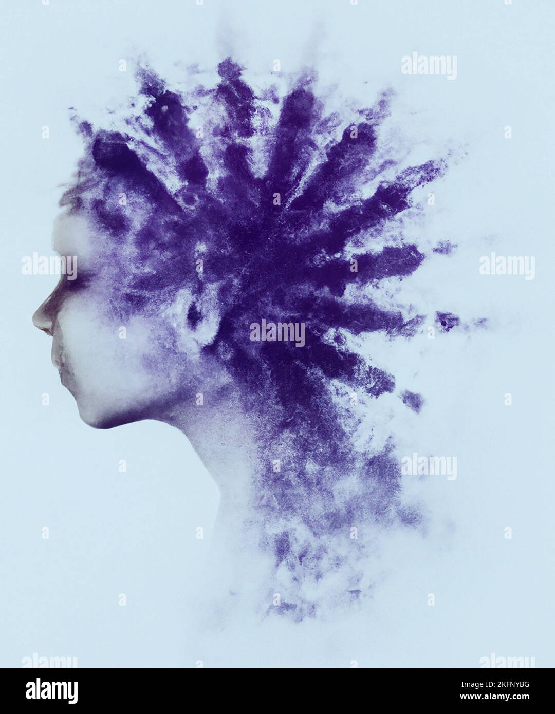 Face seen from the side. Brain problems. Degenerative disease. Bipolar ...