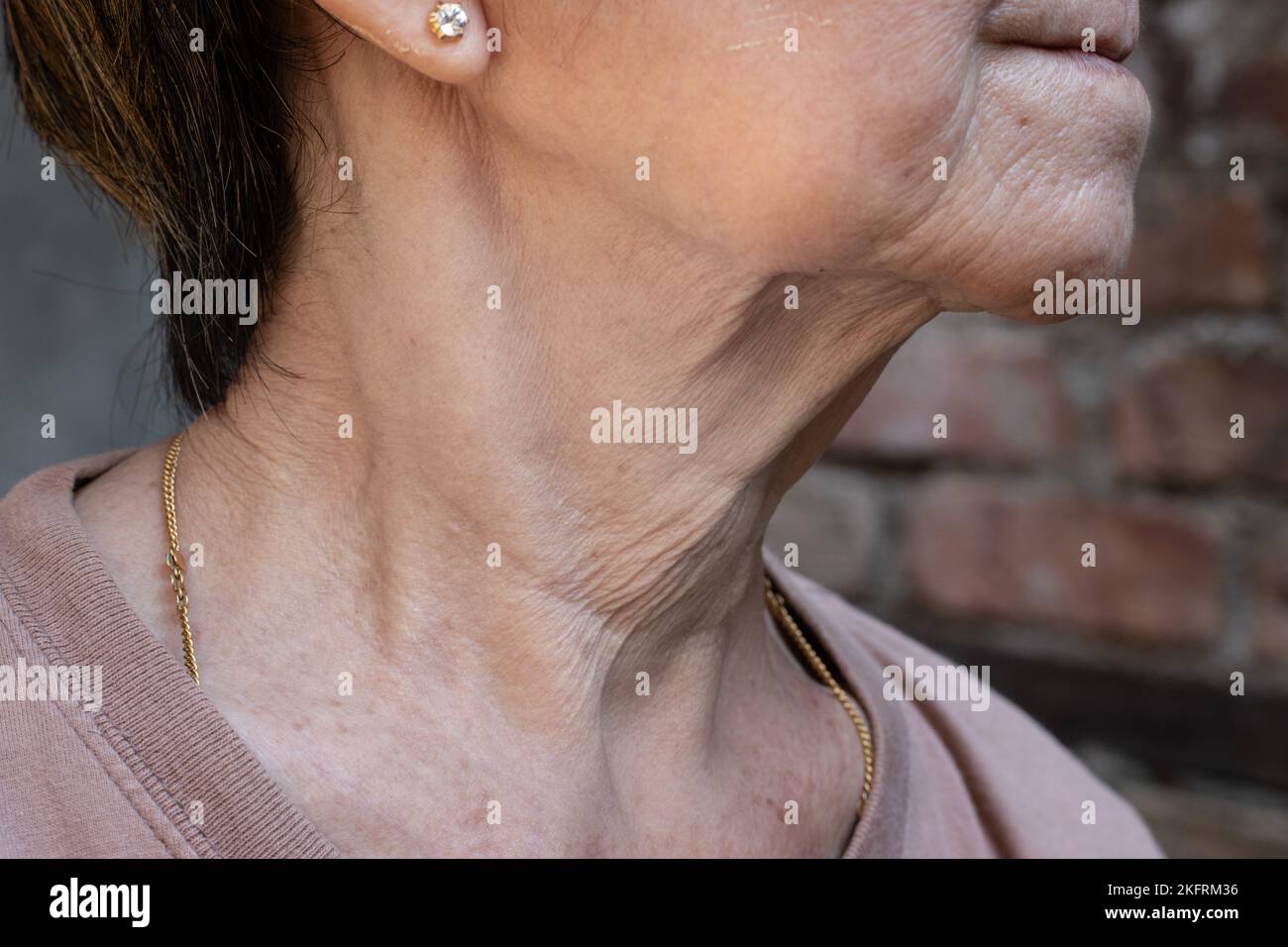 Aging skin folds or skin creases or wrinkles at neck of Southeast Asian ...