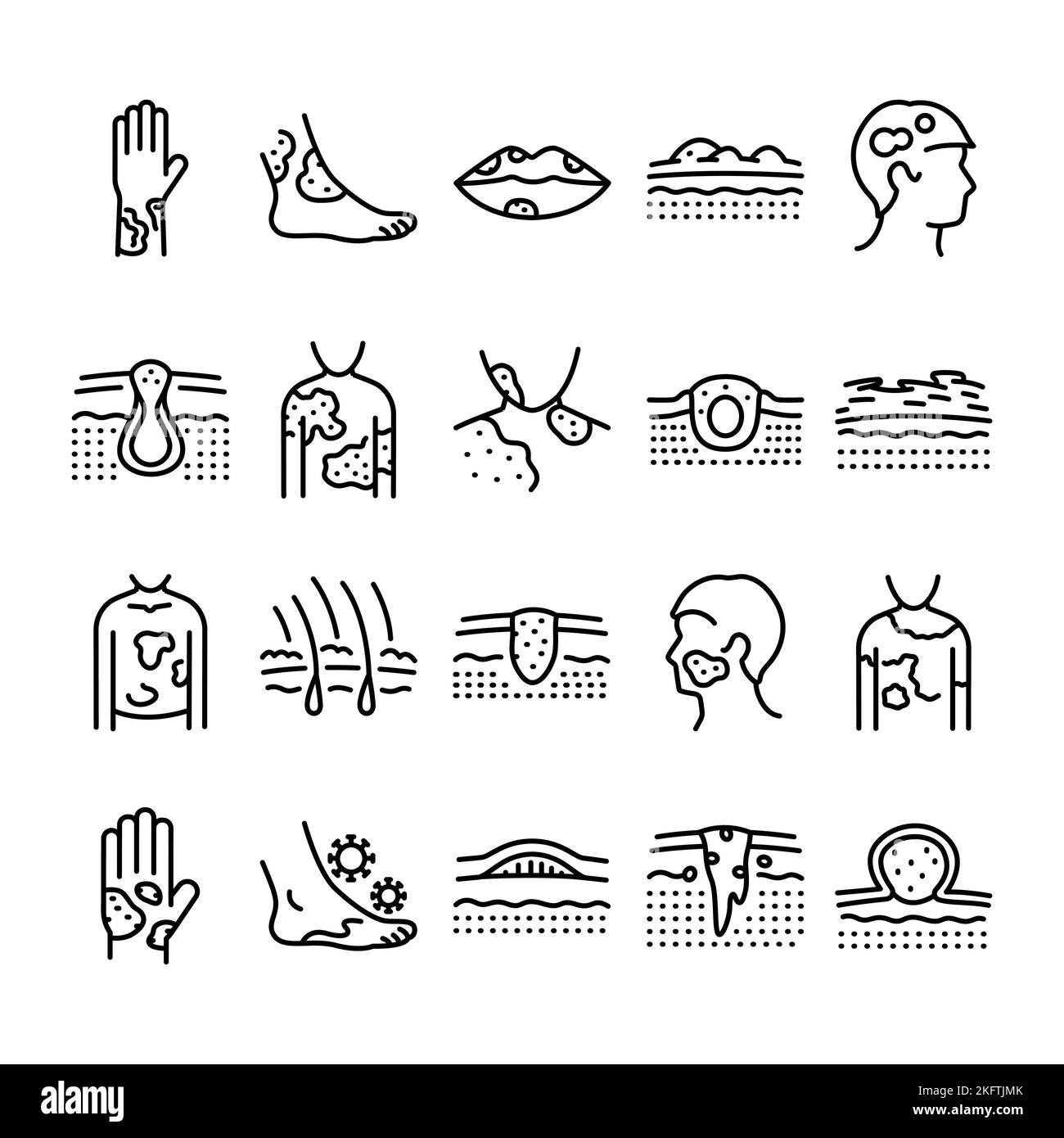 Skin Diseases Line Icons Set Dermatology Problems Disease Vitiligo