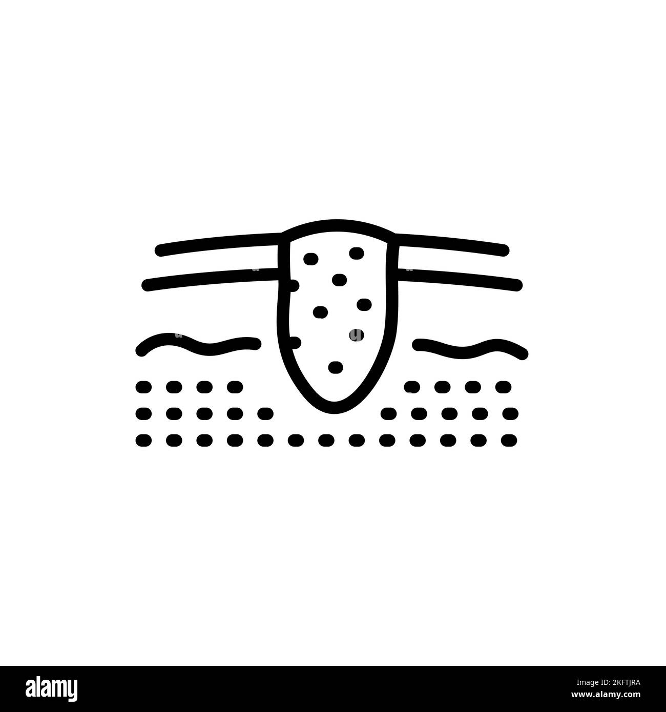 Skin Cancer Black Line Icon Dermatology Disease Stock Vector Image