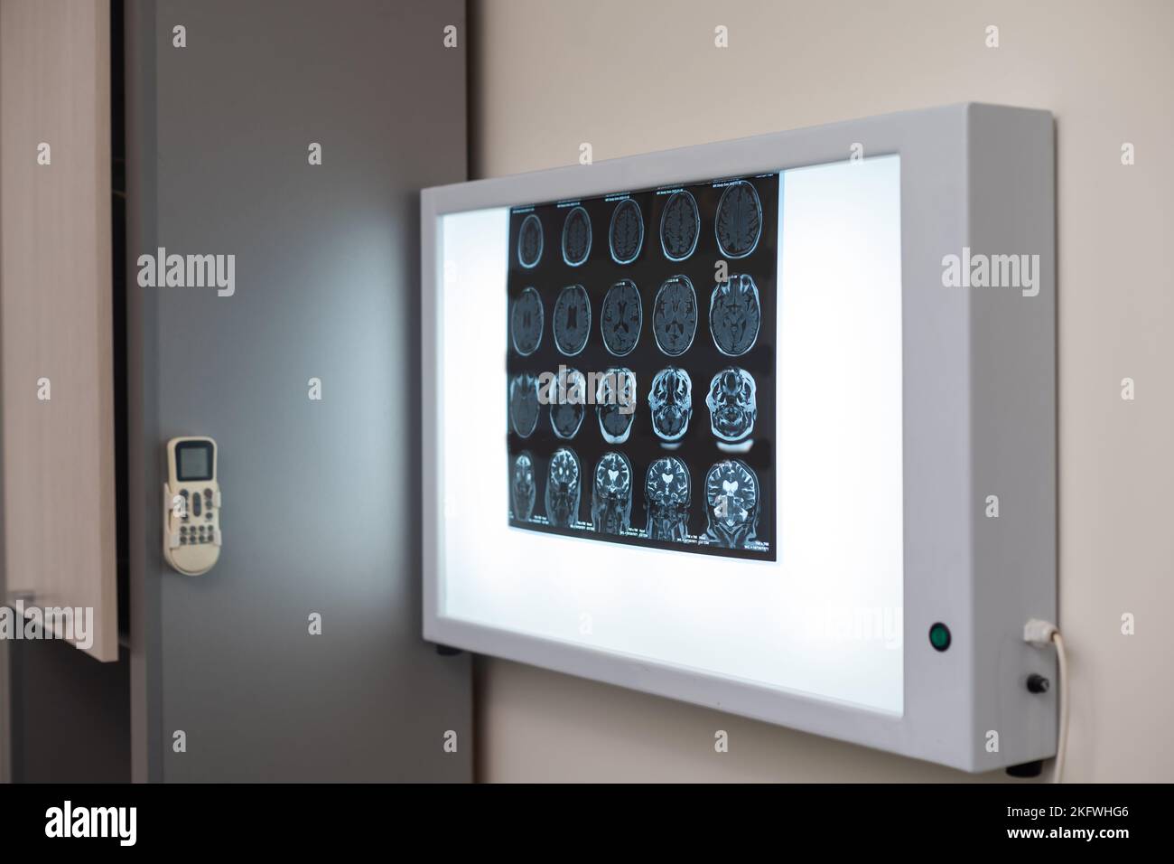 In Medical Laboratory Patient Undergoes MRI or CT Scan Process under ...