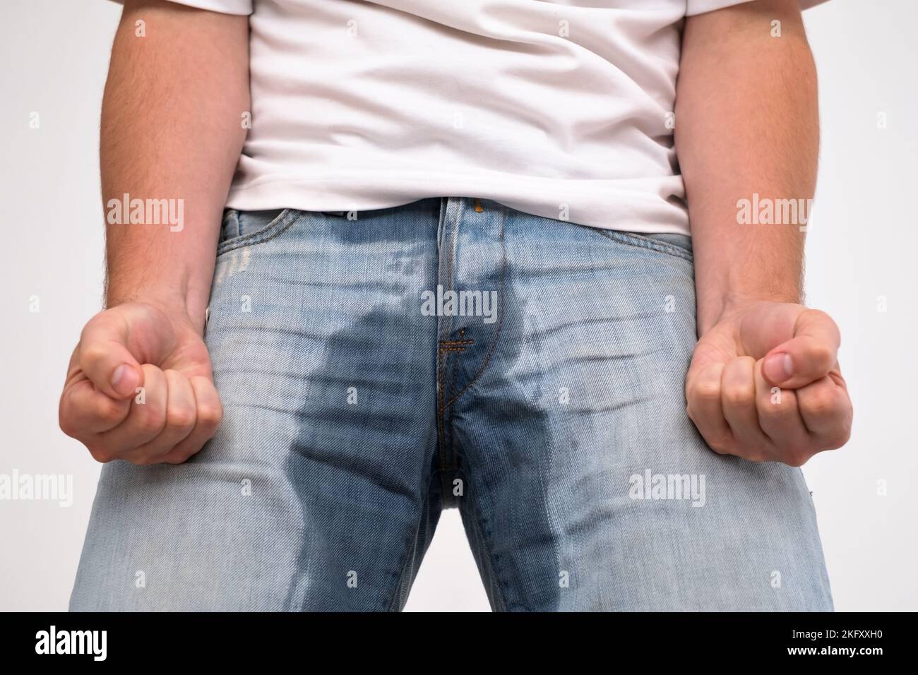 Man with prostate complication have problem with urinary incontinence ...