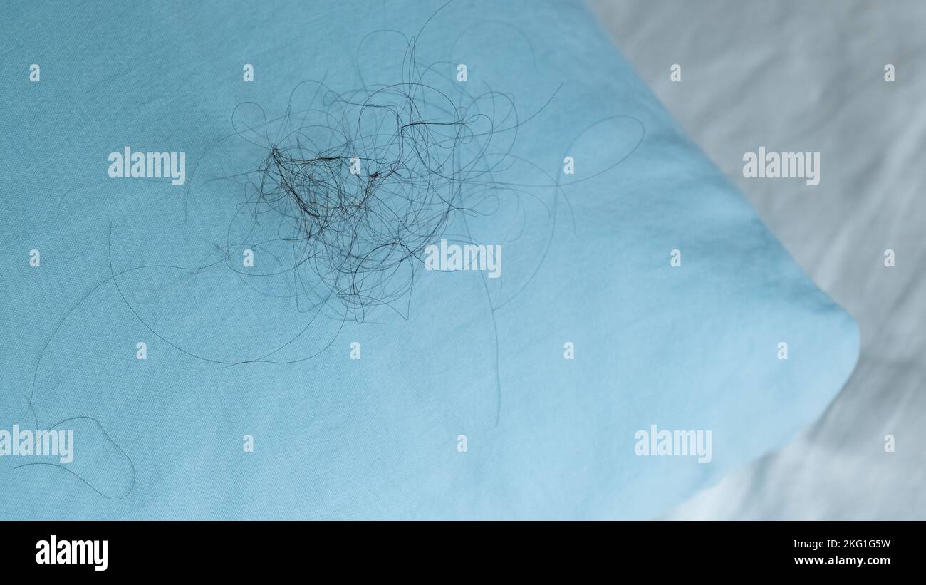 Fallen long hair on the blue pillow. Baldness problem Stock Photo - Alamy