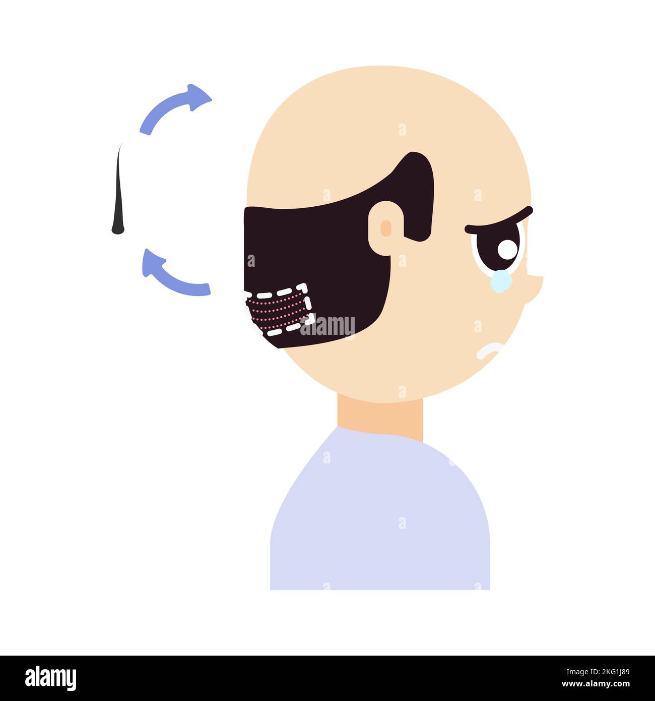 Fue hair loss treatment Cut Out Stock Images & Pictures - Alamy