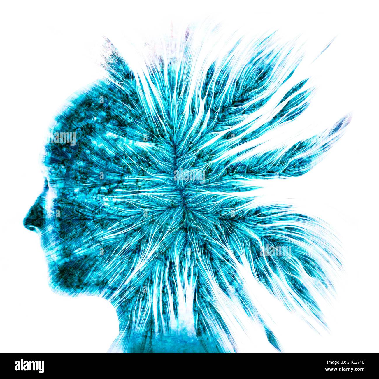 Face seen from the side. Brain problems. Degenerative disease. Bipolar ...