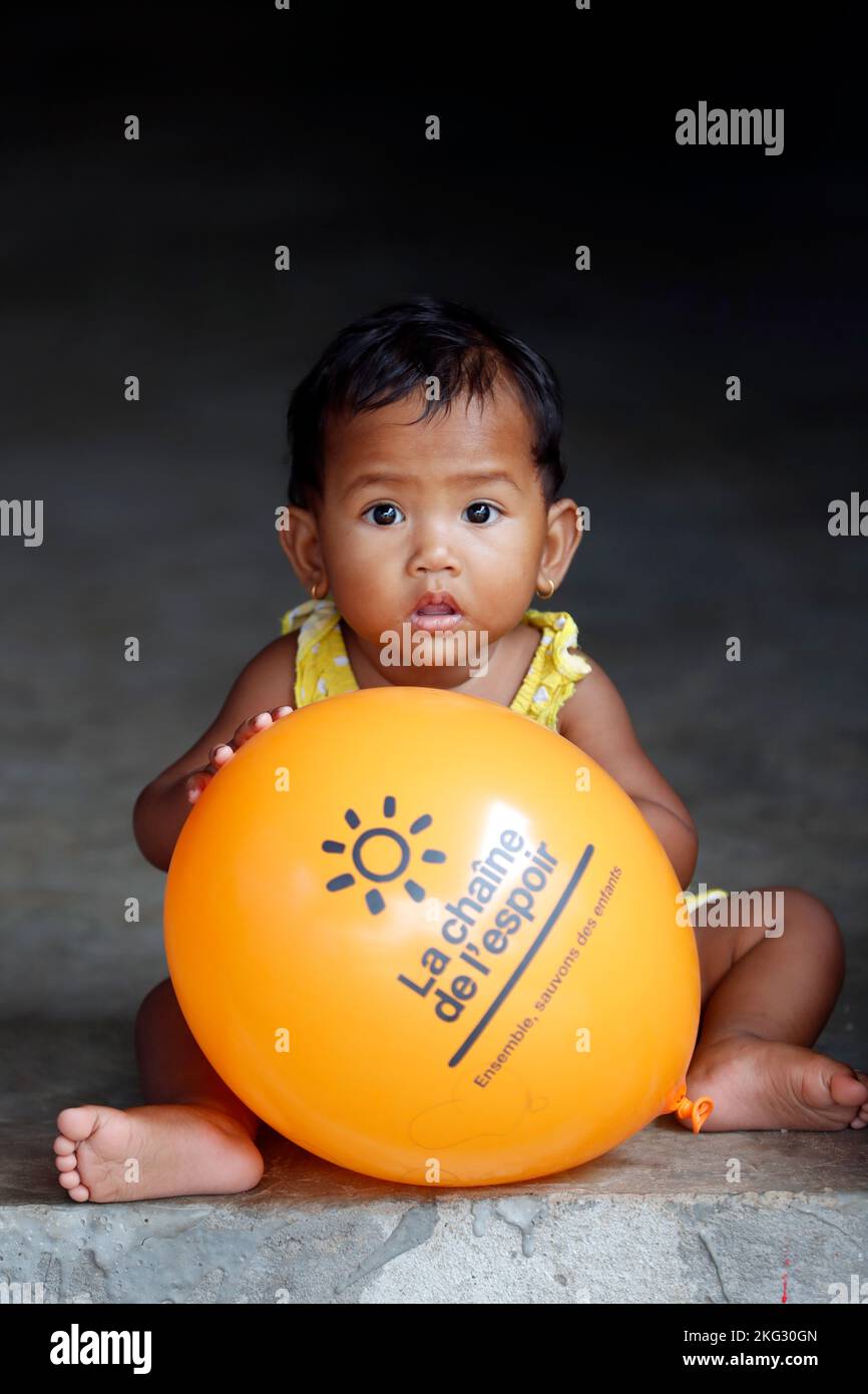 Calmette hospital. Child suffering of congenital heart disease. French ...