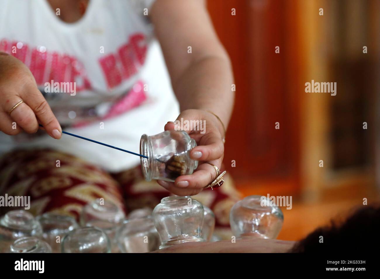 Woman receiving a cupping therapy. Multiple vacuum cup of medical ...