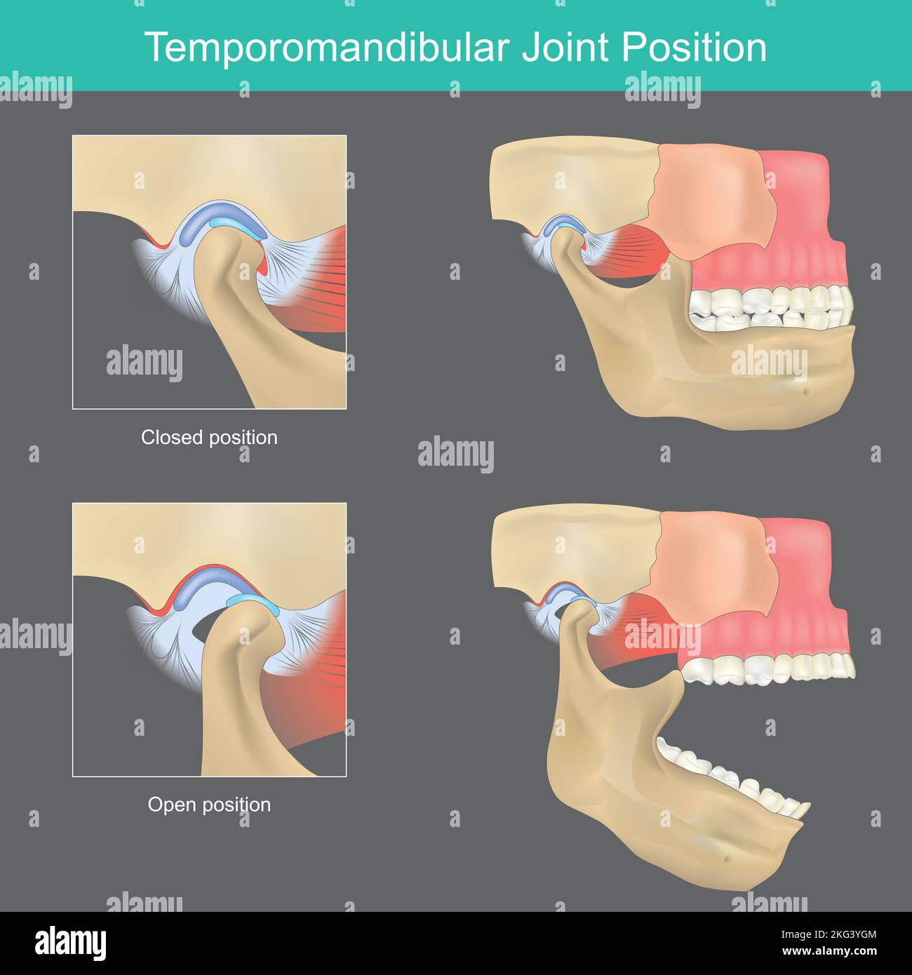 Temporomandibular joint position. when open your mouth this acts like a ...
