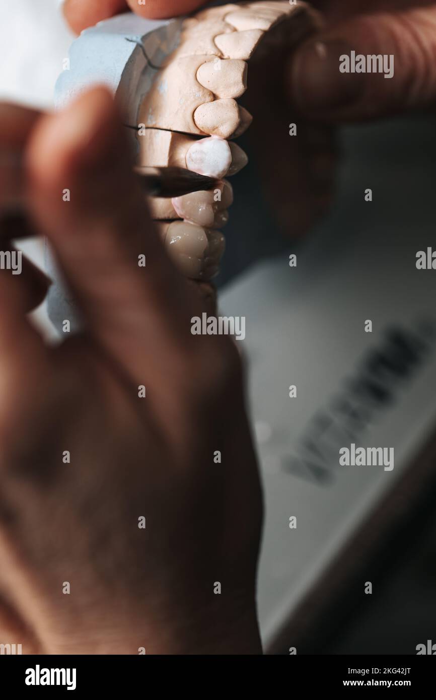 Dental Technician Making Ceramic Crowns Stock Photo - Alamy
