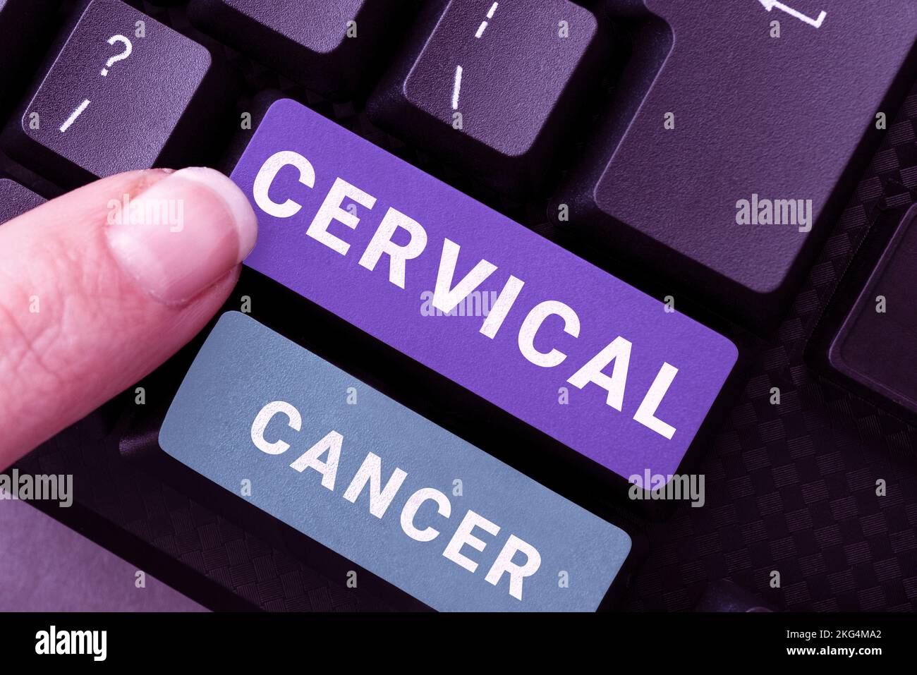Writing displaying text Cervical Cancer. Conceptual photo type of ...