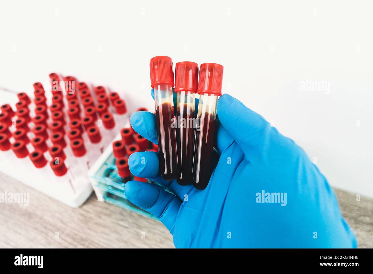 A blood test sample tube with a red cap is in the hand of a blue gloved ...