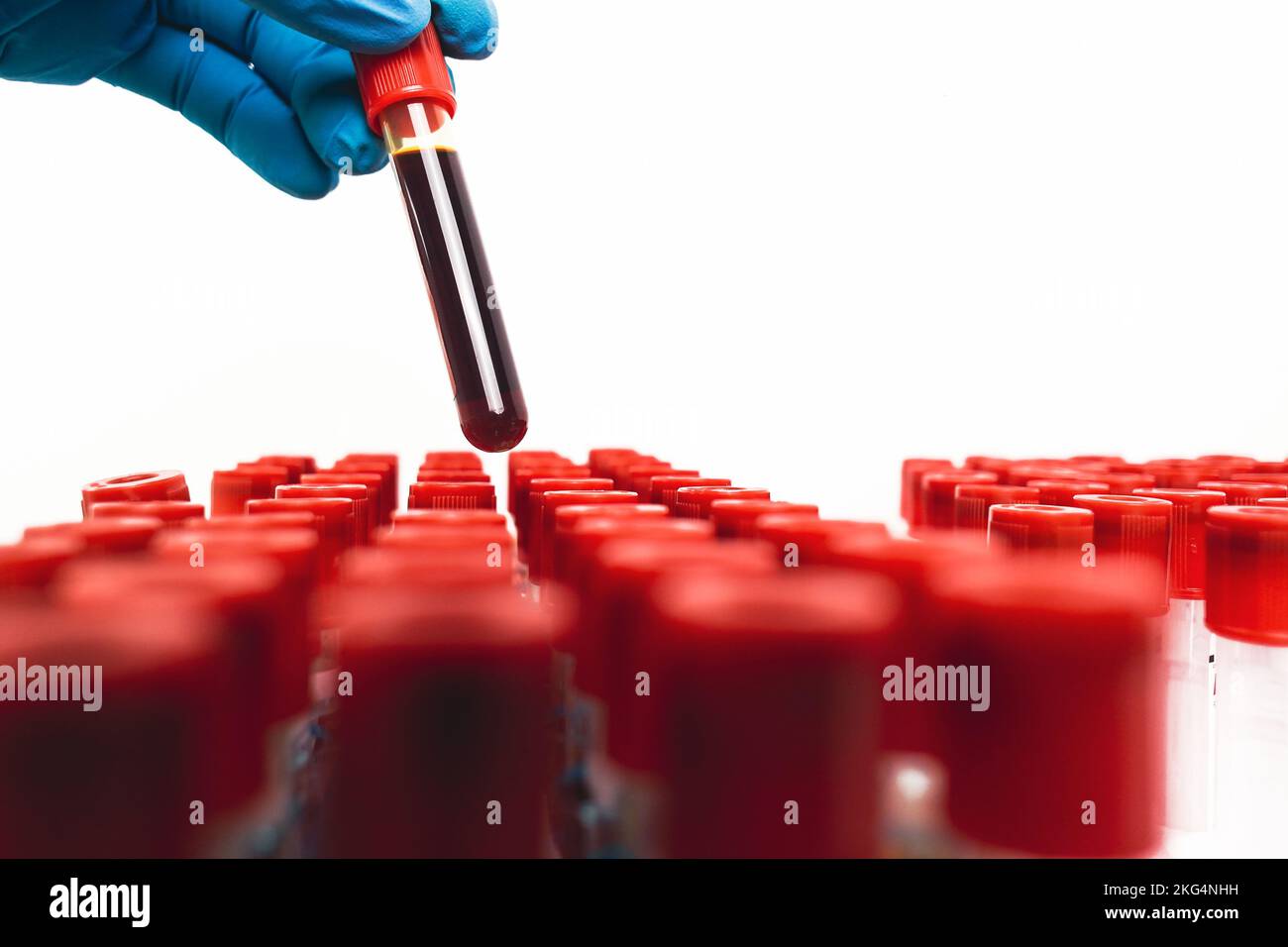 A blood test sample tube with a red cap is in the hand of a blue gloved ...