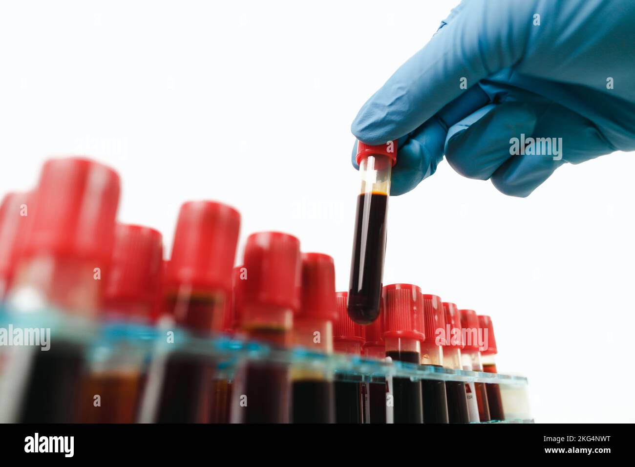 A blood test sample tube with a red cap is in the hand of a blue gloved ...