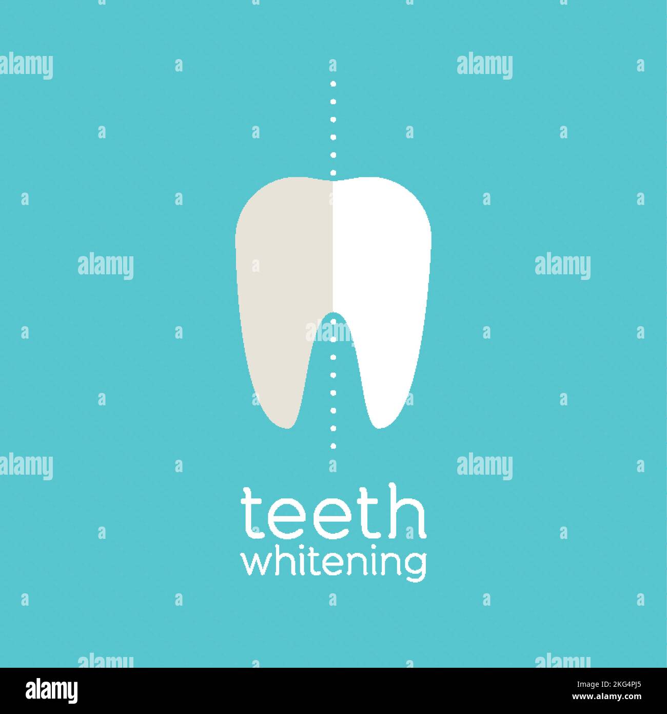 Teeth whitening. Before and after. Dental concepts. Vector illustration ...