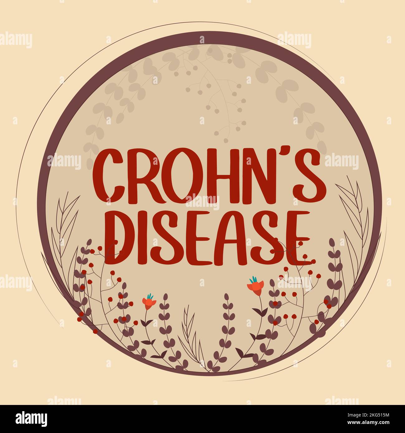 Text sign showing Crohn S Is Disease. Conceptual photo the chronic ...