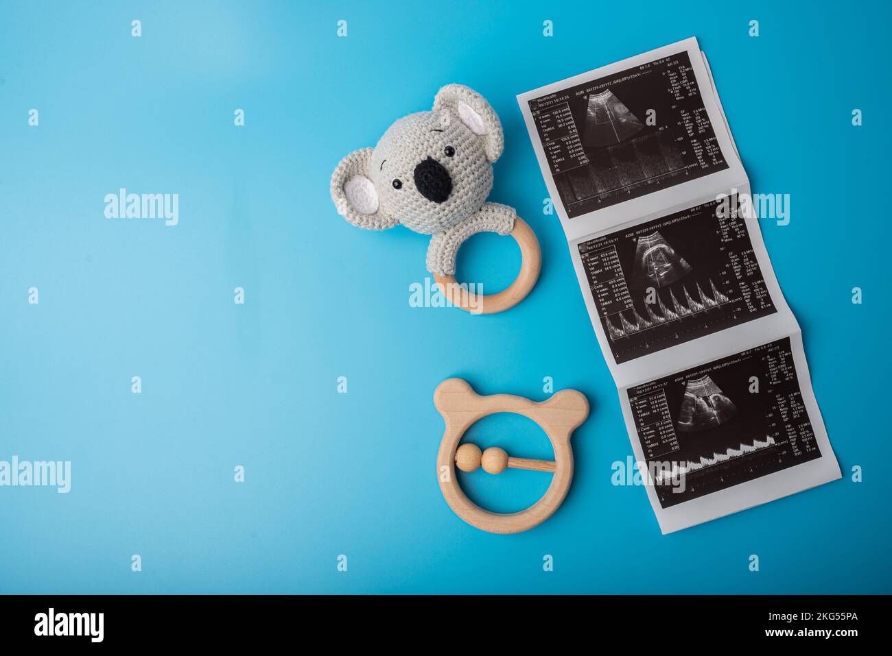 ultrasound picture with toys for boy on blue bacground Stock Photo - Alamy
