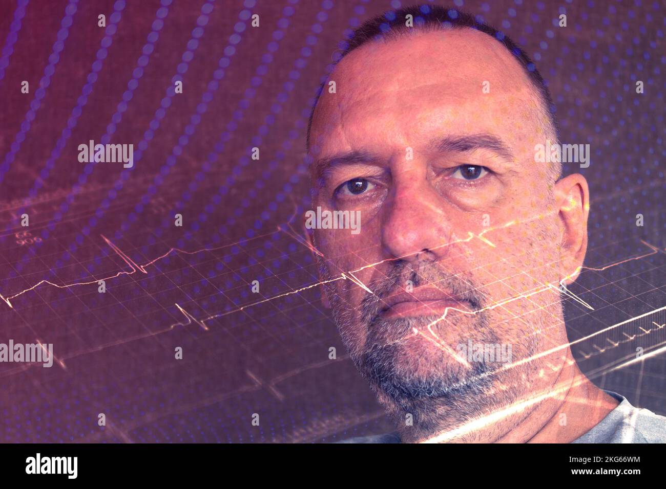 Man superimposed on an electrocardiogram. Double exposure. Cardiology ...