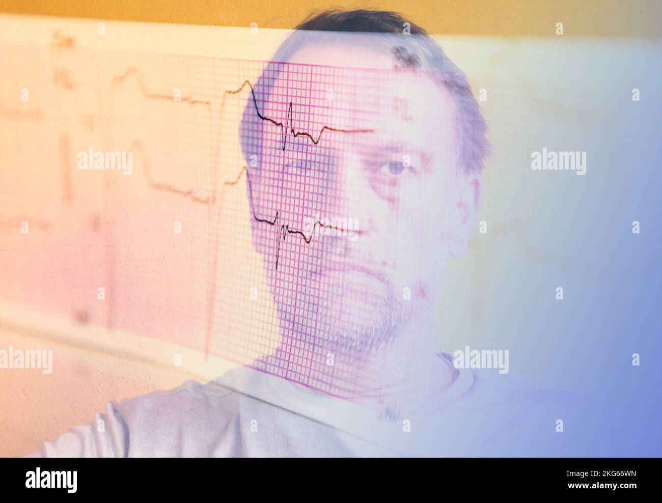 Man superimposed on an electrocardiogram. Double exposure. Cardiology ...