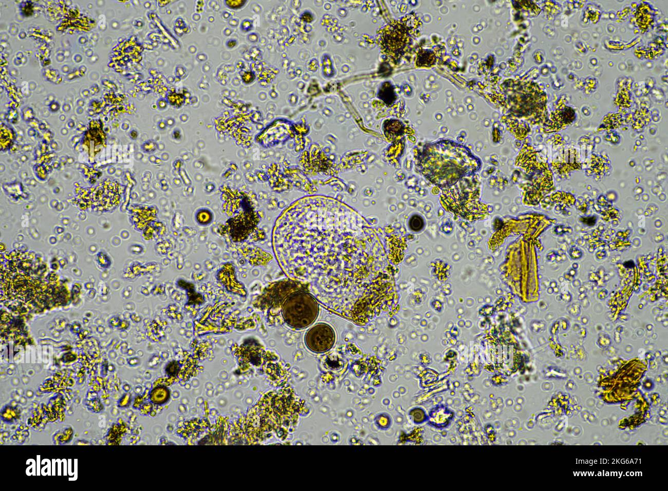 insect parasite in the soil in australia on a farm Stock Photo - Alamy