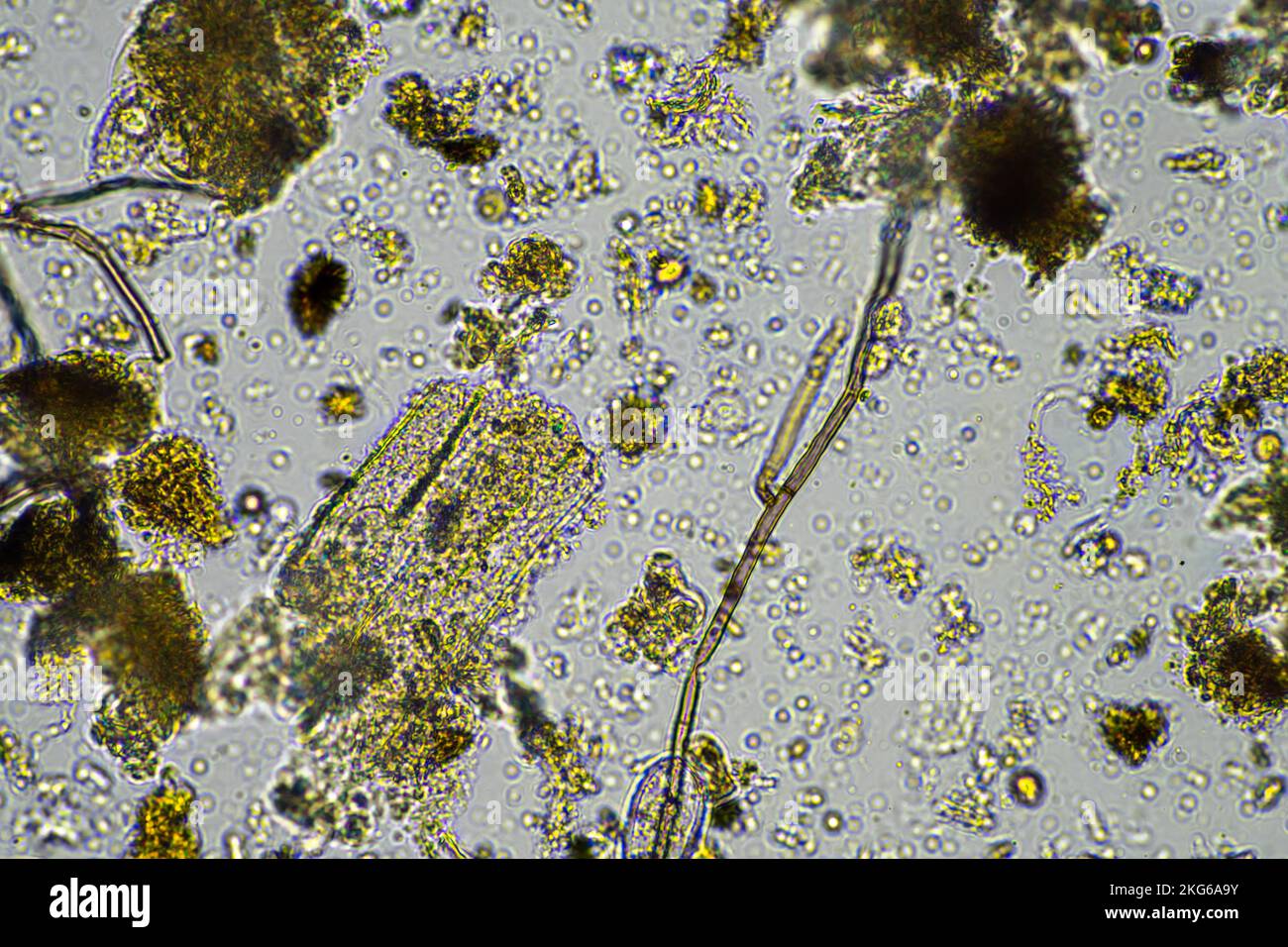 microscopic worm in the soil in australia in compost Stock Photo - Alamy