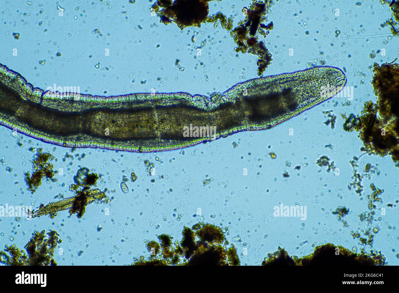 human parasite. gut intestinal infection disease. microorganism ...