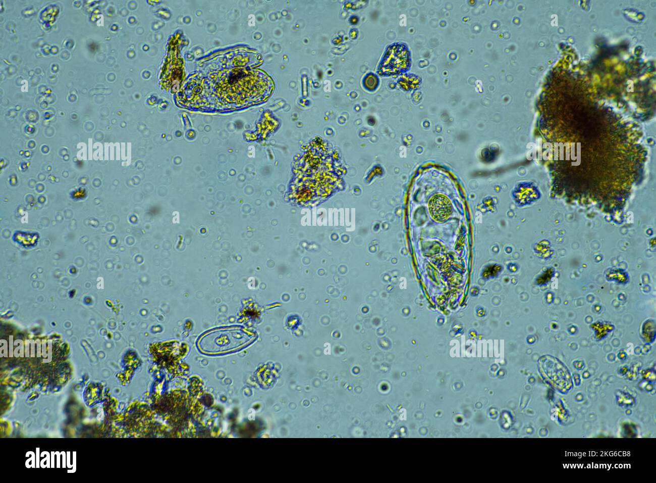 human parasite. gut intestinal infection disease. microorganism ...