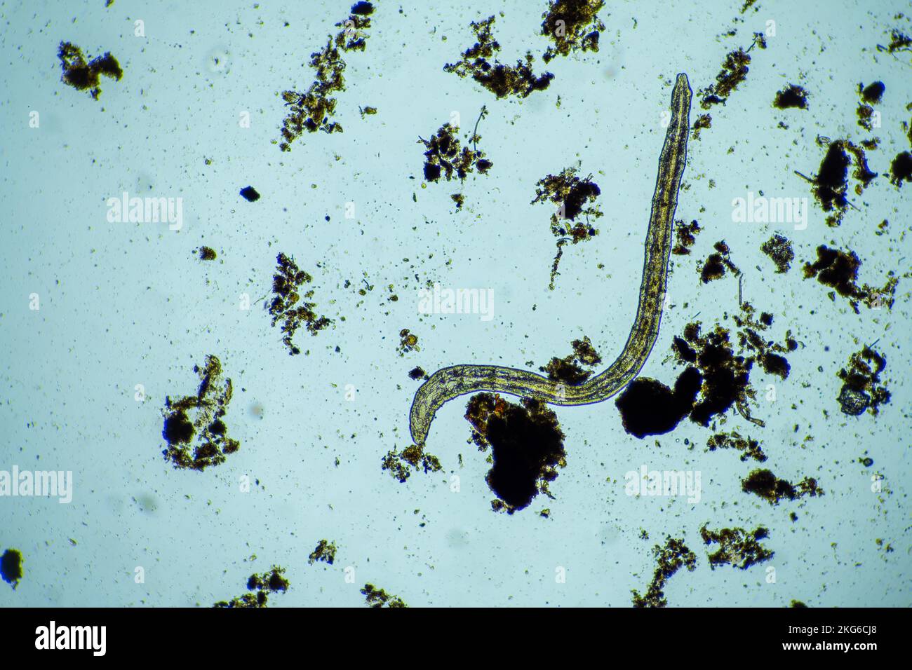 human parasite. gut intestinal infection disease. microorganism ...