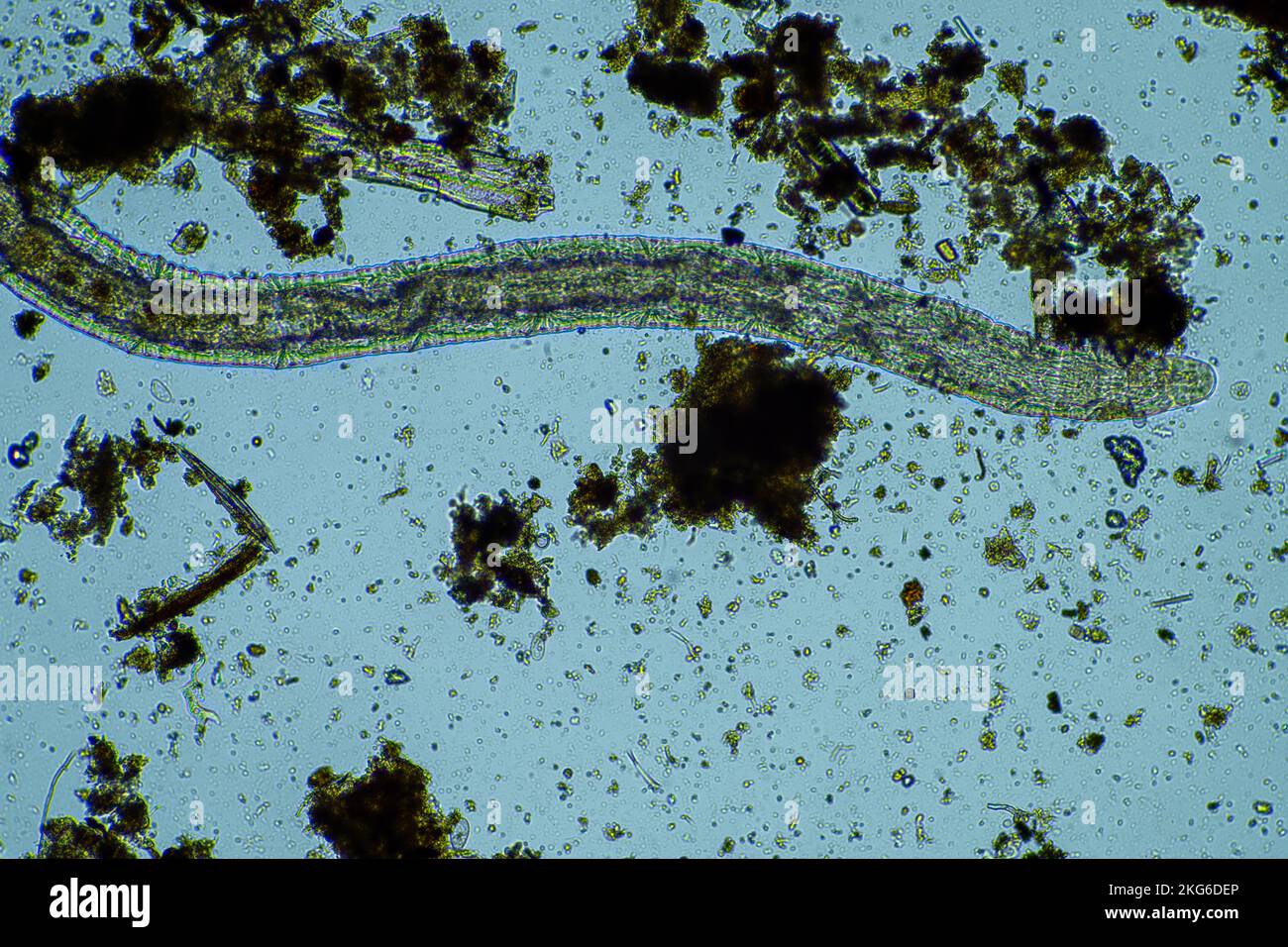 Bacteria on finger microscope hi-res stock photography and images - Alamy