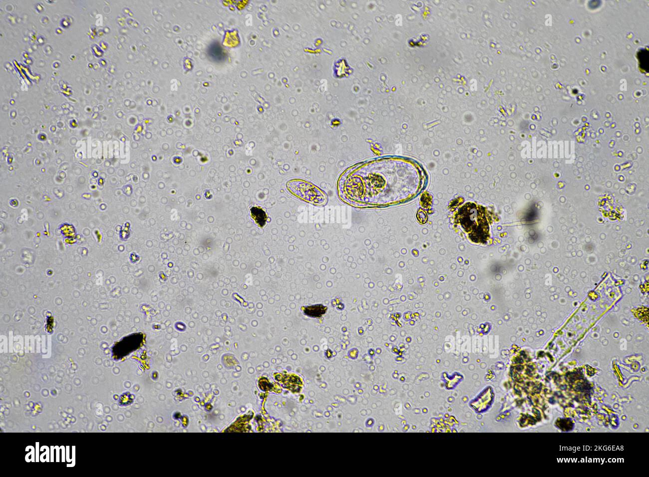 insect parasite in the soil in australia on a farm Stock Photo - Alamy