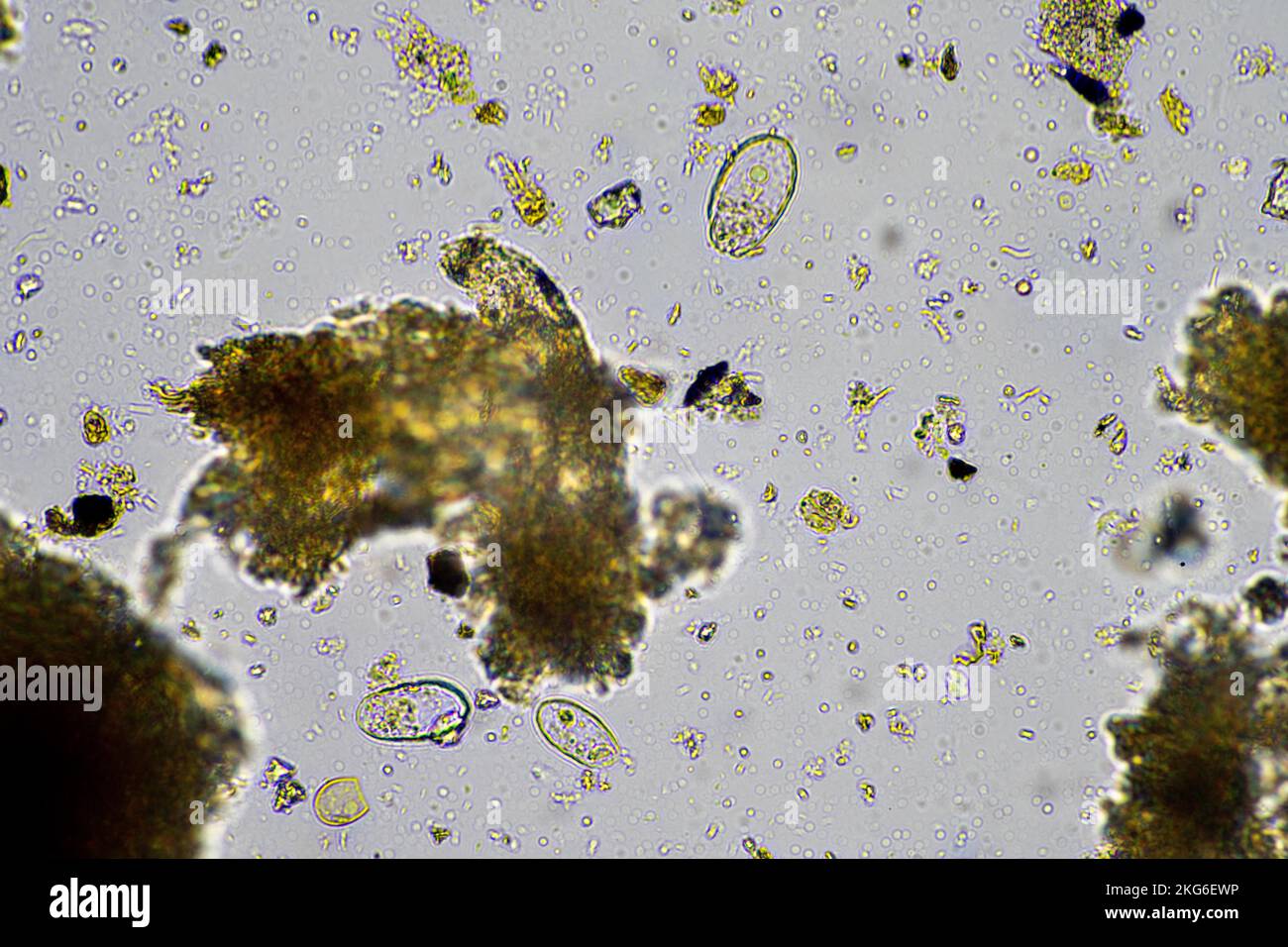 human parasite. gut intestinal infection disease. microorganism ...