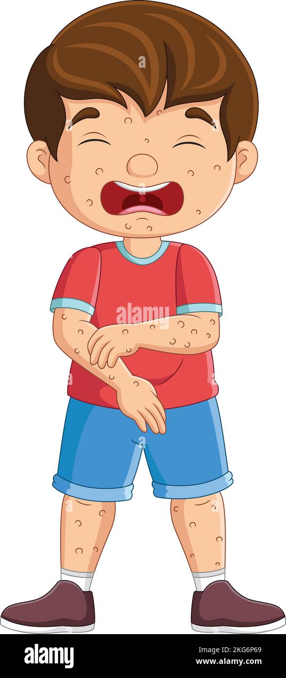 Little boy chicken pox Stock Vector Images - Alamy