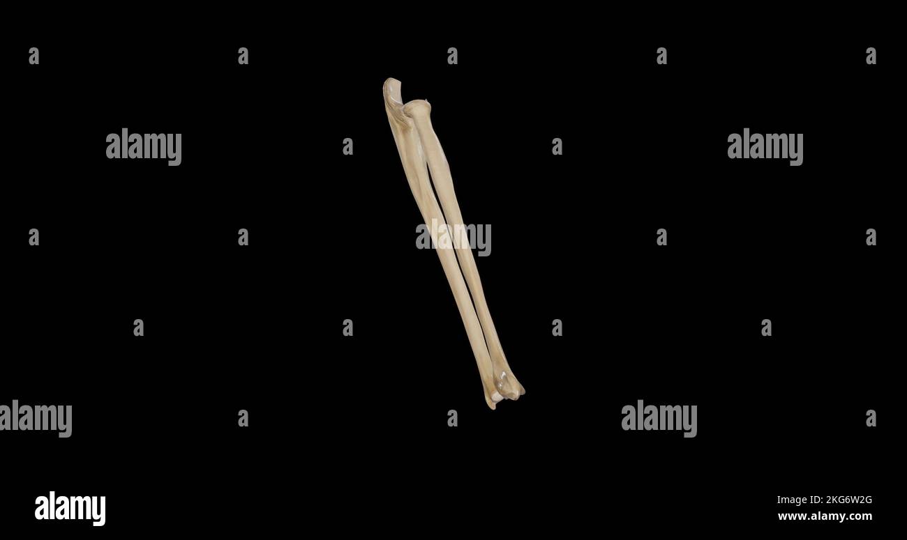 Forearm bones hi-res stock photography and images - Alamy