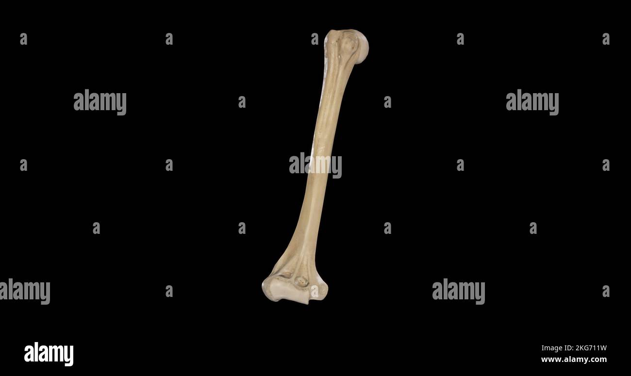Lesser Tuberosity Humerus