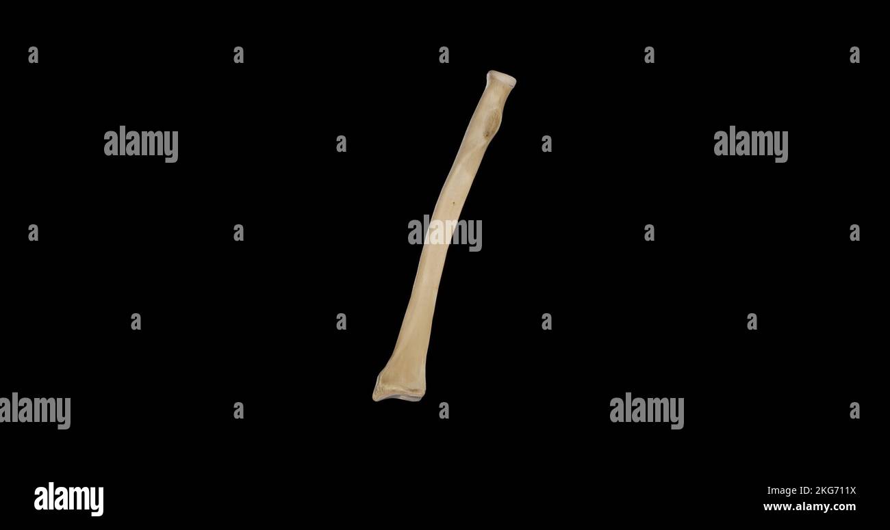 Distal radius hi-res stock photography and images - Alamy