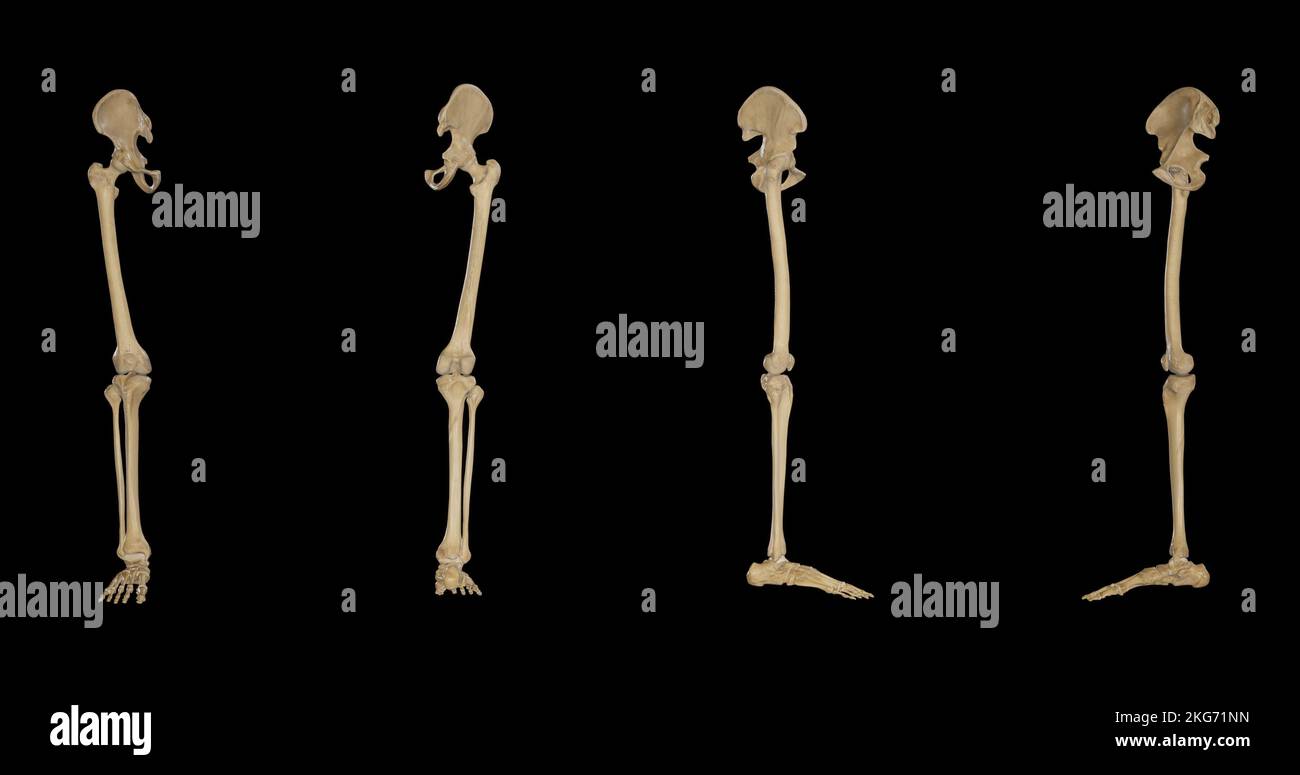 Neck of femur fractures hi-res stock photography and images - Alamy