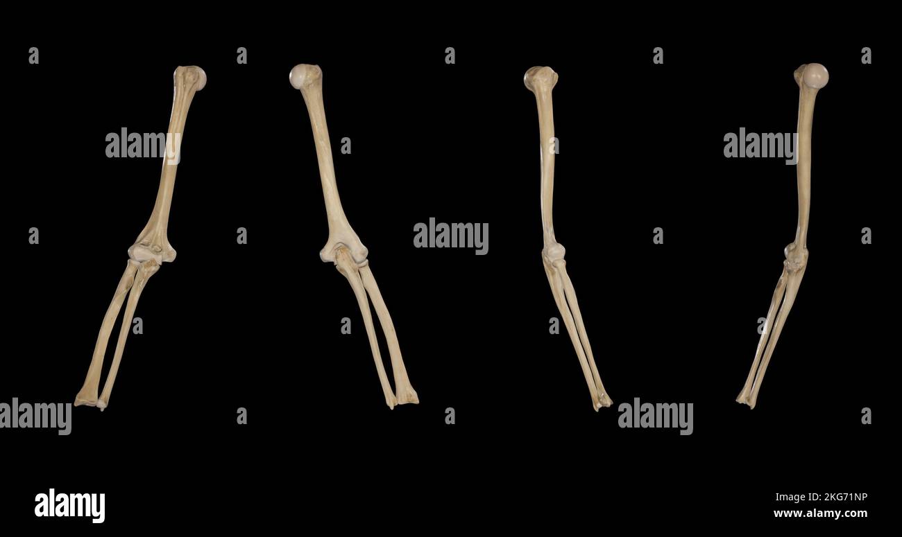 Inferior radioulnar joint hi-res stock photography and images - Alamy