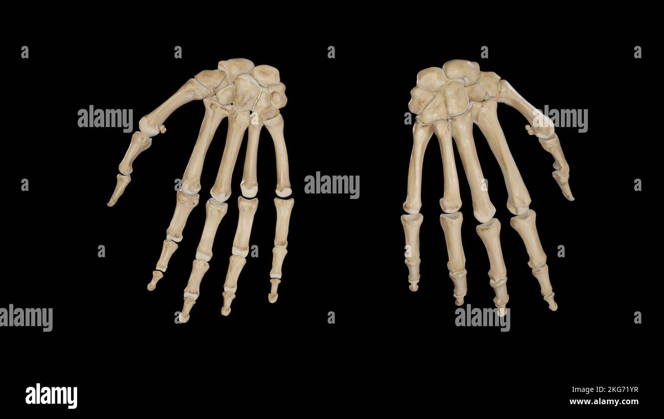 Bones of the wrist palmar view hi-res stock photography and images - Alamy