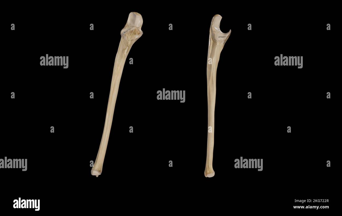 Supinator Fossa Of Ulna
