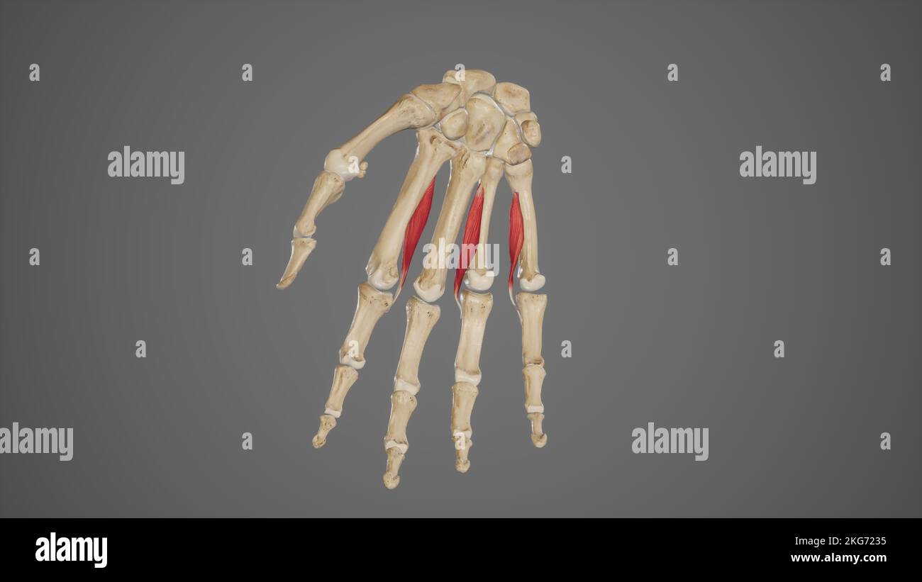 Interossei muscles of hand hi-res stock photography and images - Alamy