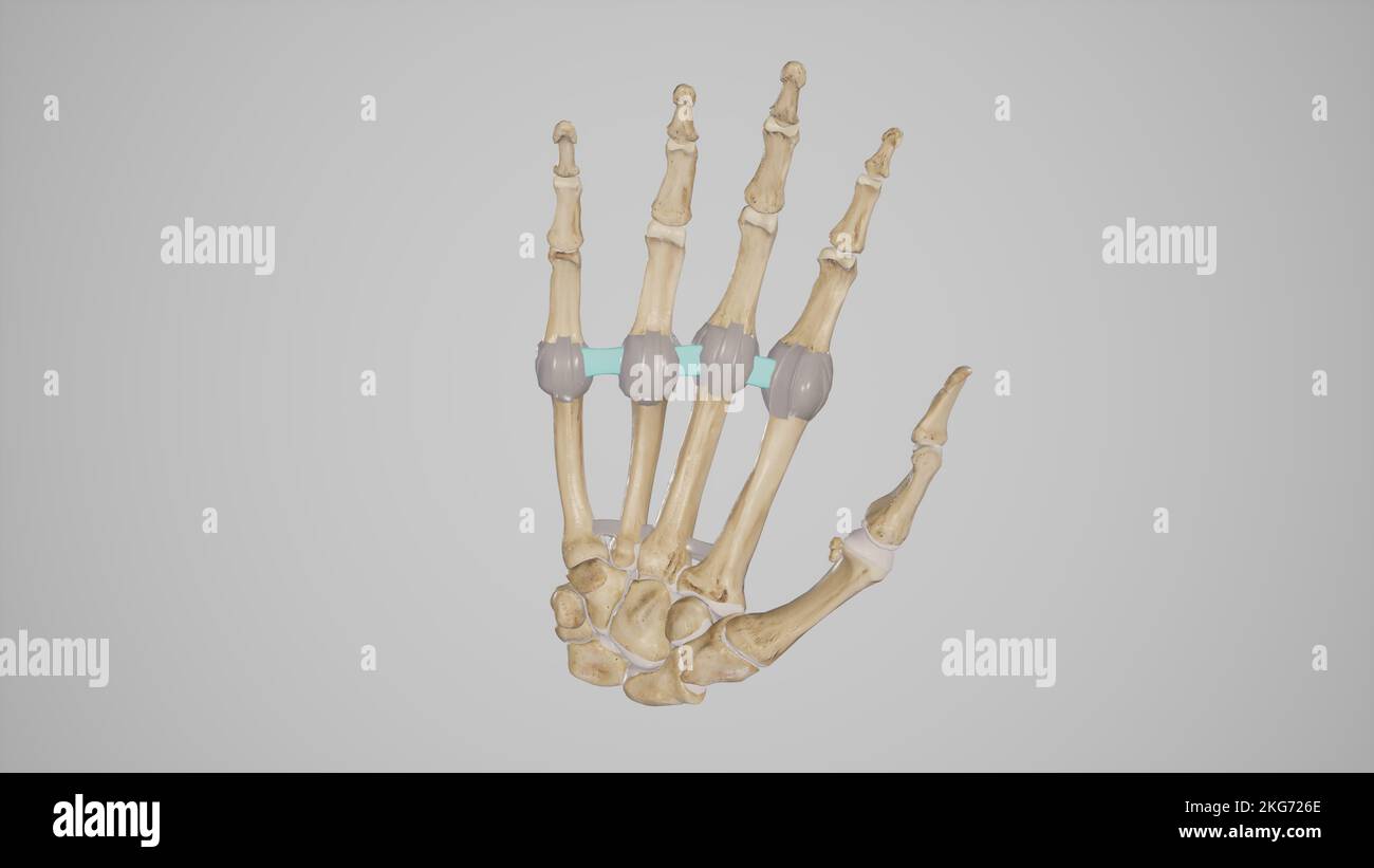 Deep Transverse Metacarpal Ligaments Stock Photo - Alamy