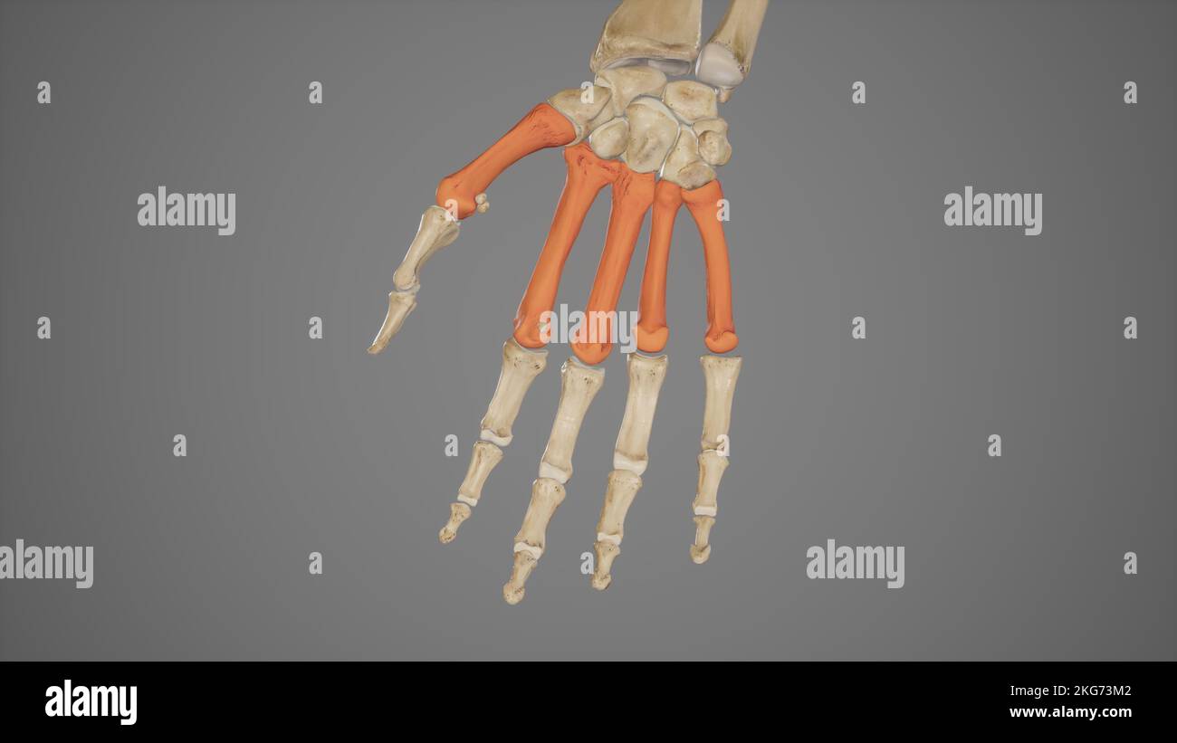 Medical Illustration of Metacarpal Bones Stock Photo - Alamy