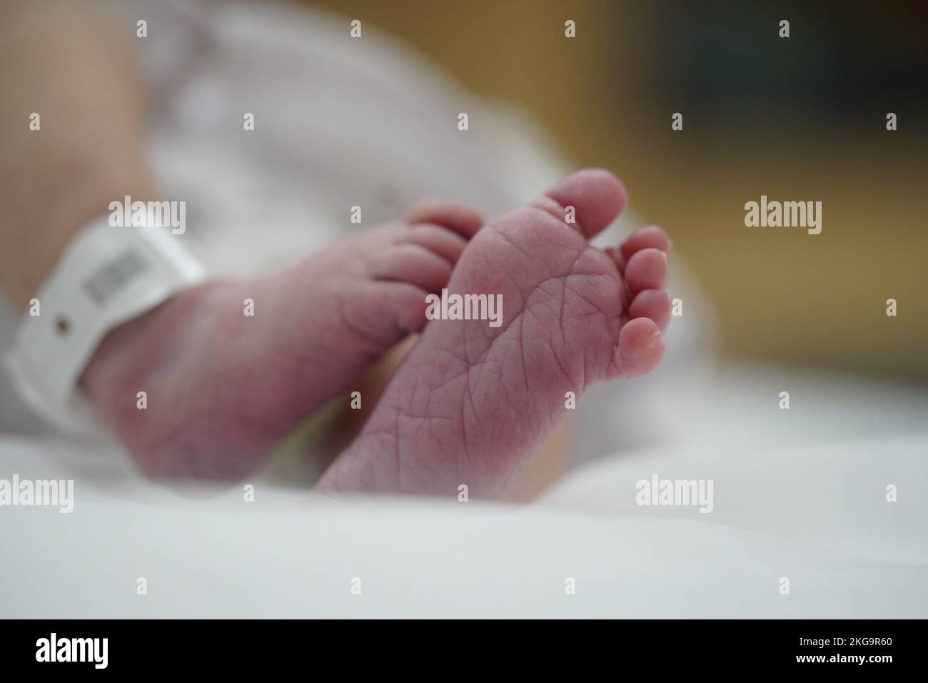 Newborn baby foot with identification bracelet in the hospital Stock ...