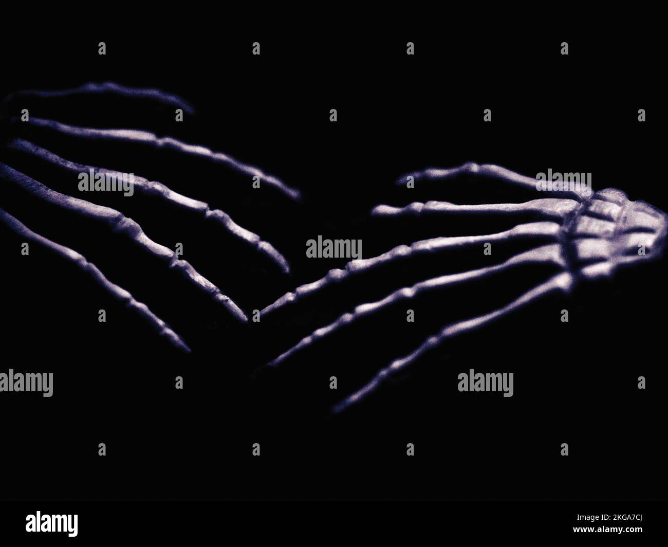 Close up of two hands in skeleton form with some parts of fingers ...