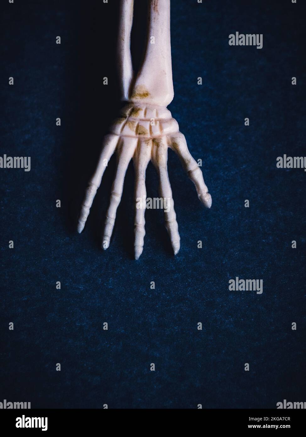 Lower arm bone hi-res stock photography and images - Alamy