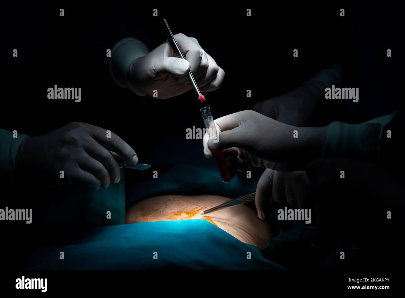 Surgical team hi-res stock photography and images - Alamy