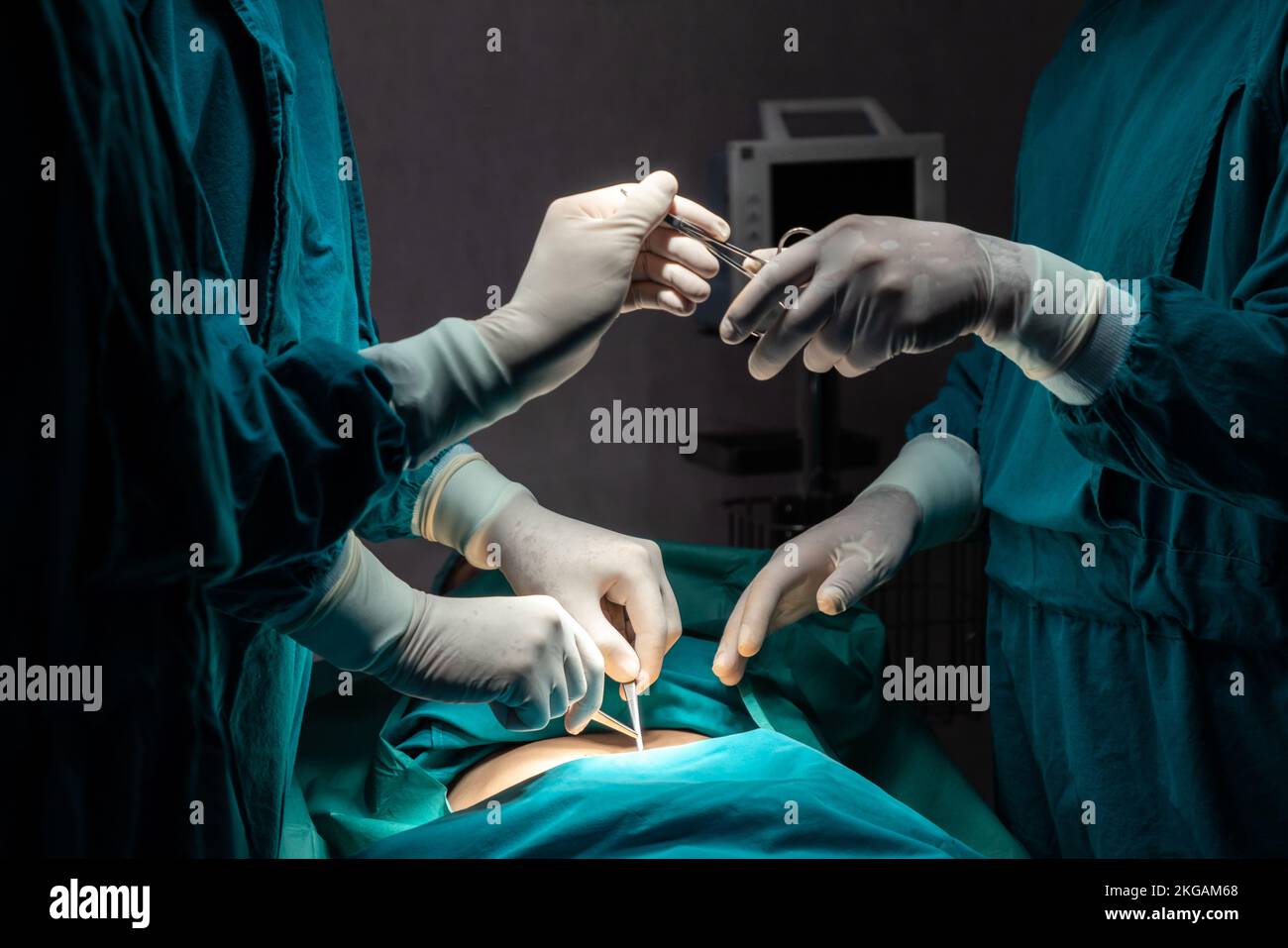 Surgical team hi-res stock photography and images - Alamy
