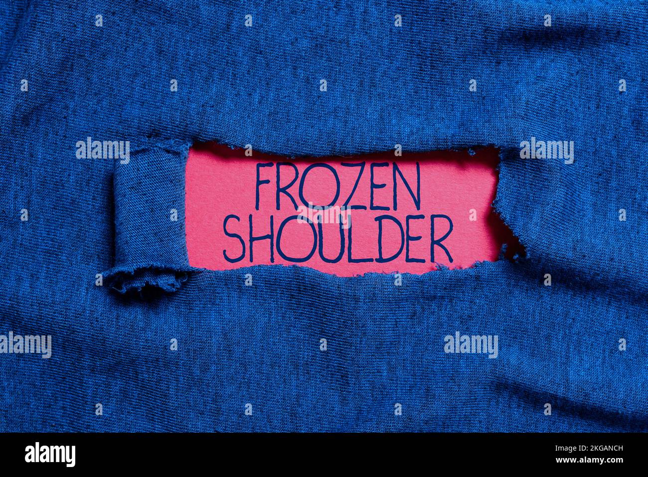 Writing displaying text Frozen Shoulder. Business concept characterized ...