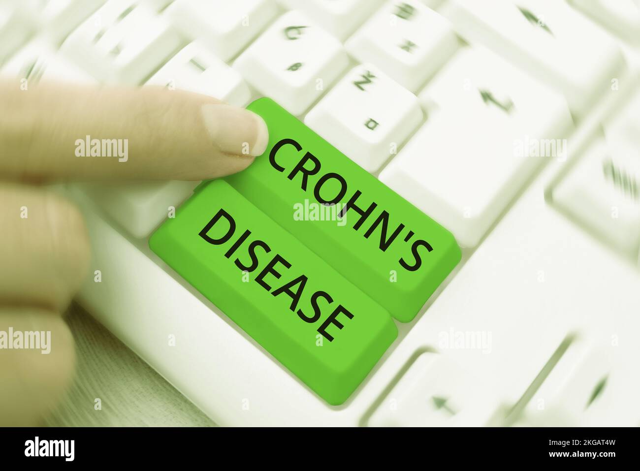 Text caption presenting Crohn S Is Disease. Concept meaning the chronic ...
