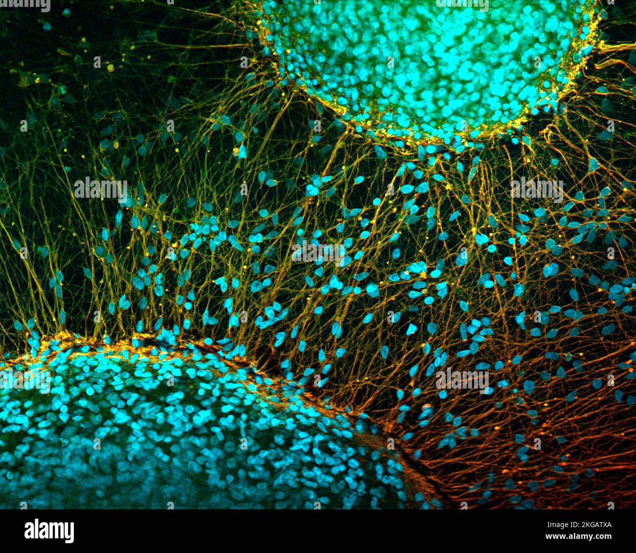 Fluorescence light micrograph of nerve cells (neurons) that have been ...